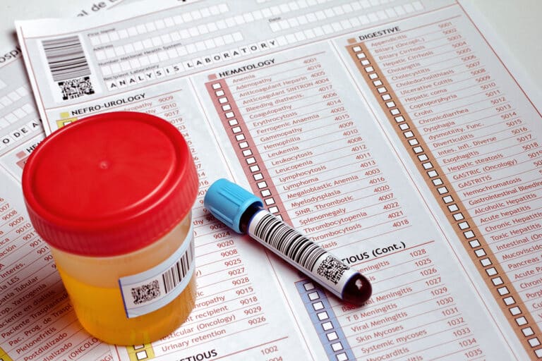 What Happens If Doctors Find Drugs in Your System? - Illinois Recovery ...